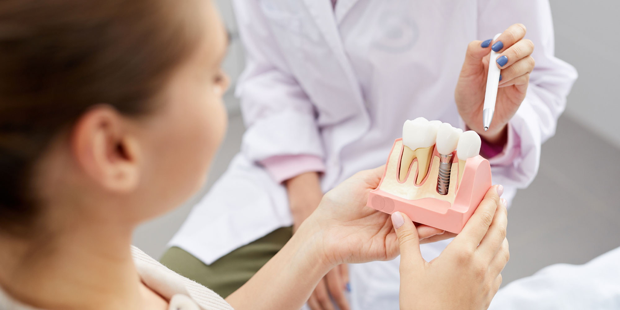 Single Dental Implants | Westminster, CO | Standley Shores Dental Group